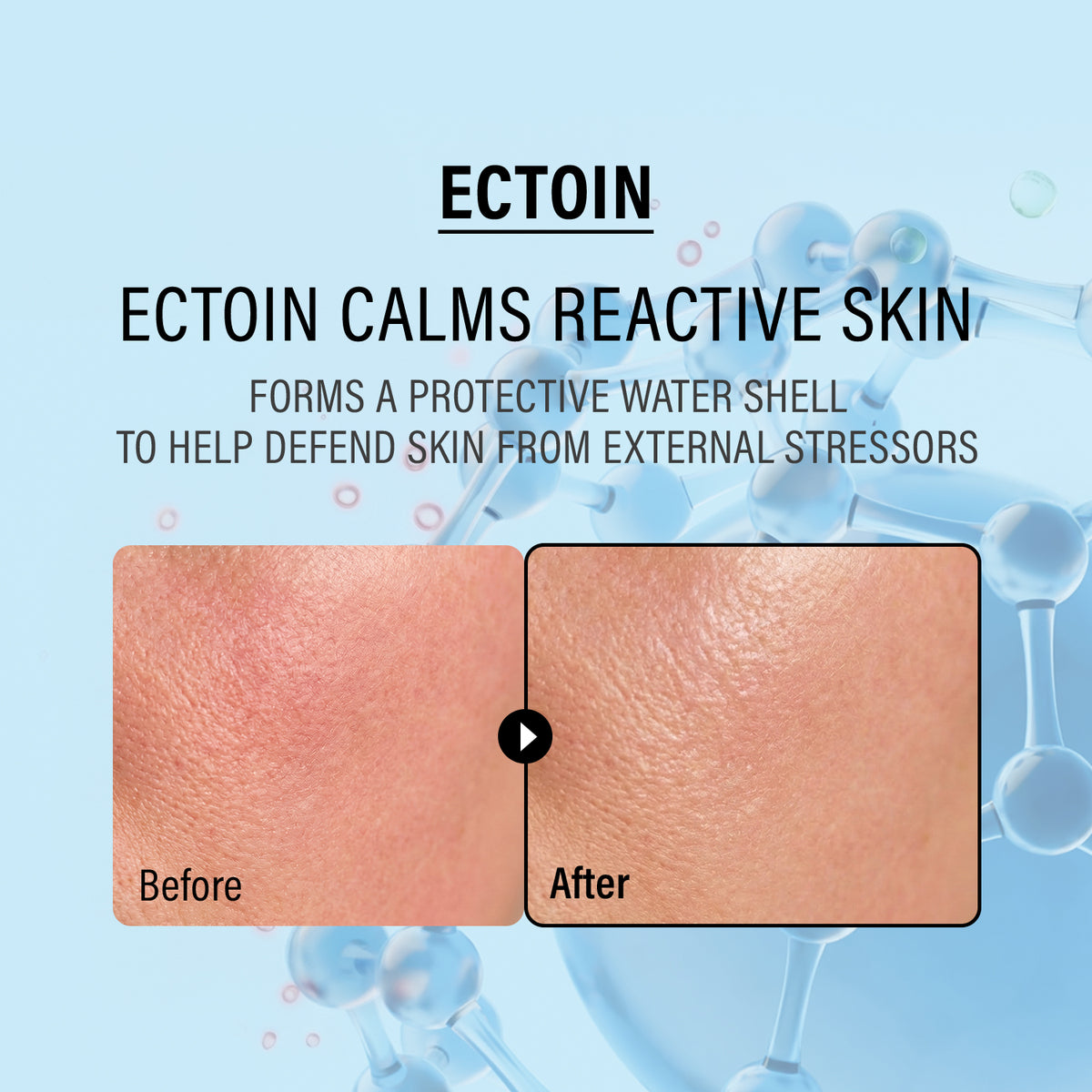 Double Up Cream - Ectoin & Panthenol – EPII IN YOUR SKIN EPISODE